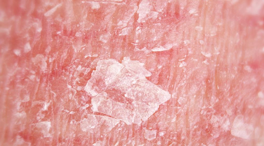 Aesthetic Medicine - 60% of Brits suffer from some form of skin disease