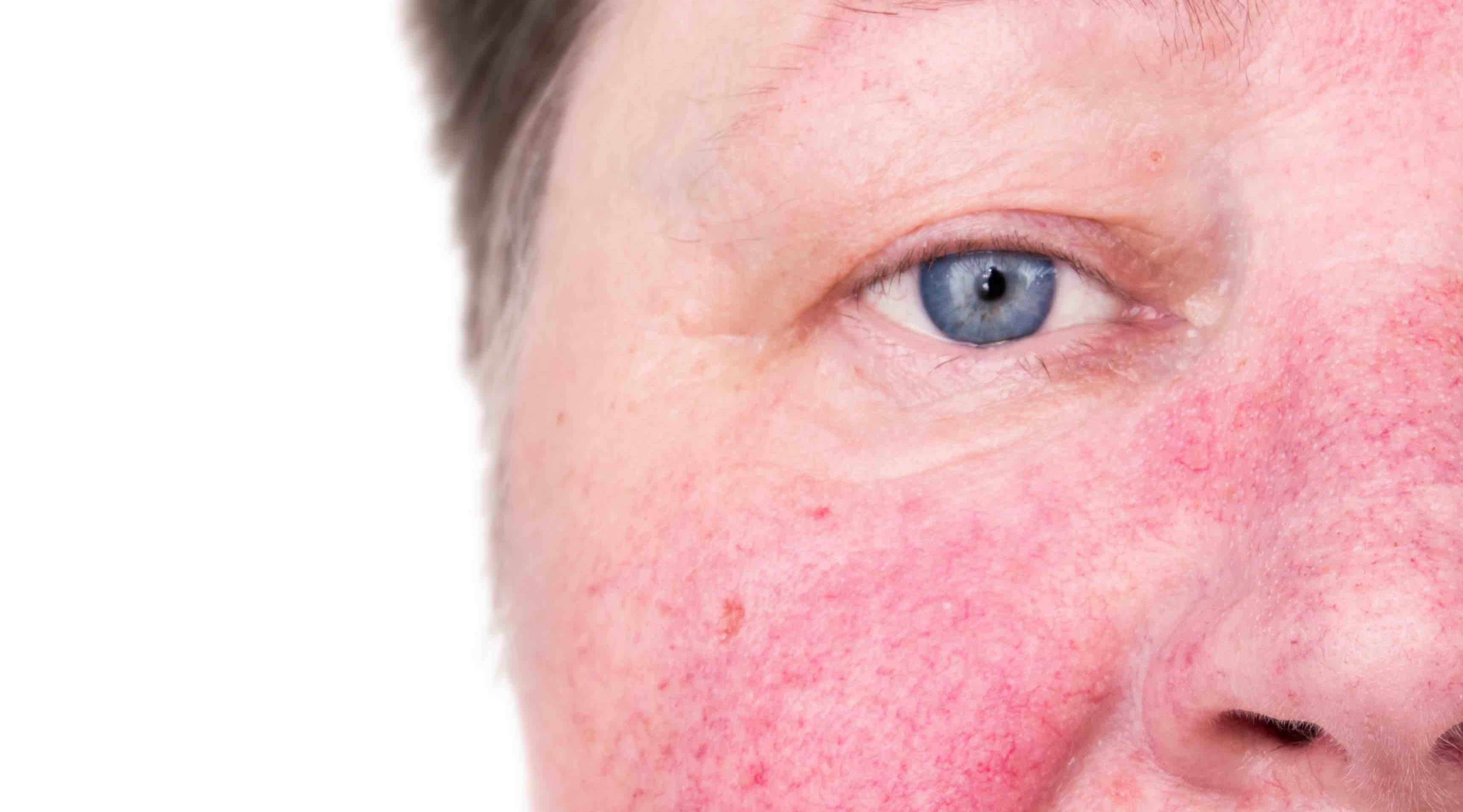 Aesthetic Medicine - New NRS standard classification and ...