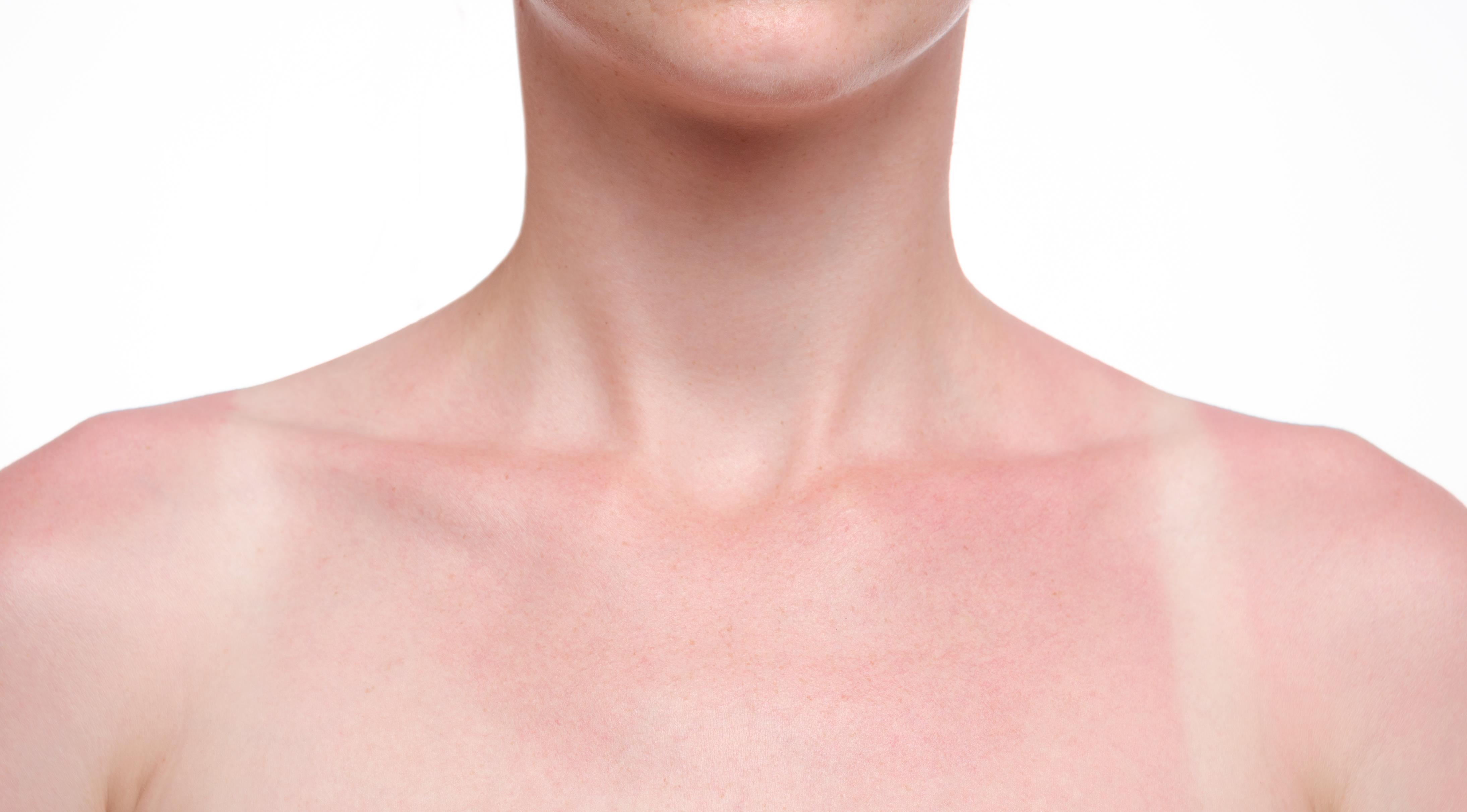 Aesthetic Medicine - Survey Finds Brits are Dying for a Tan